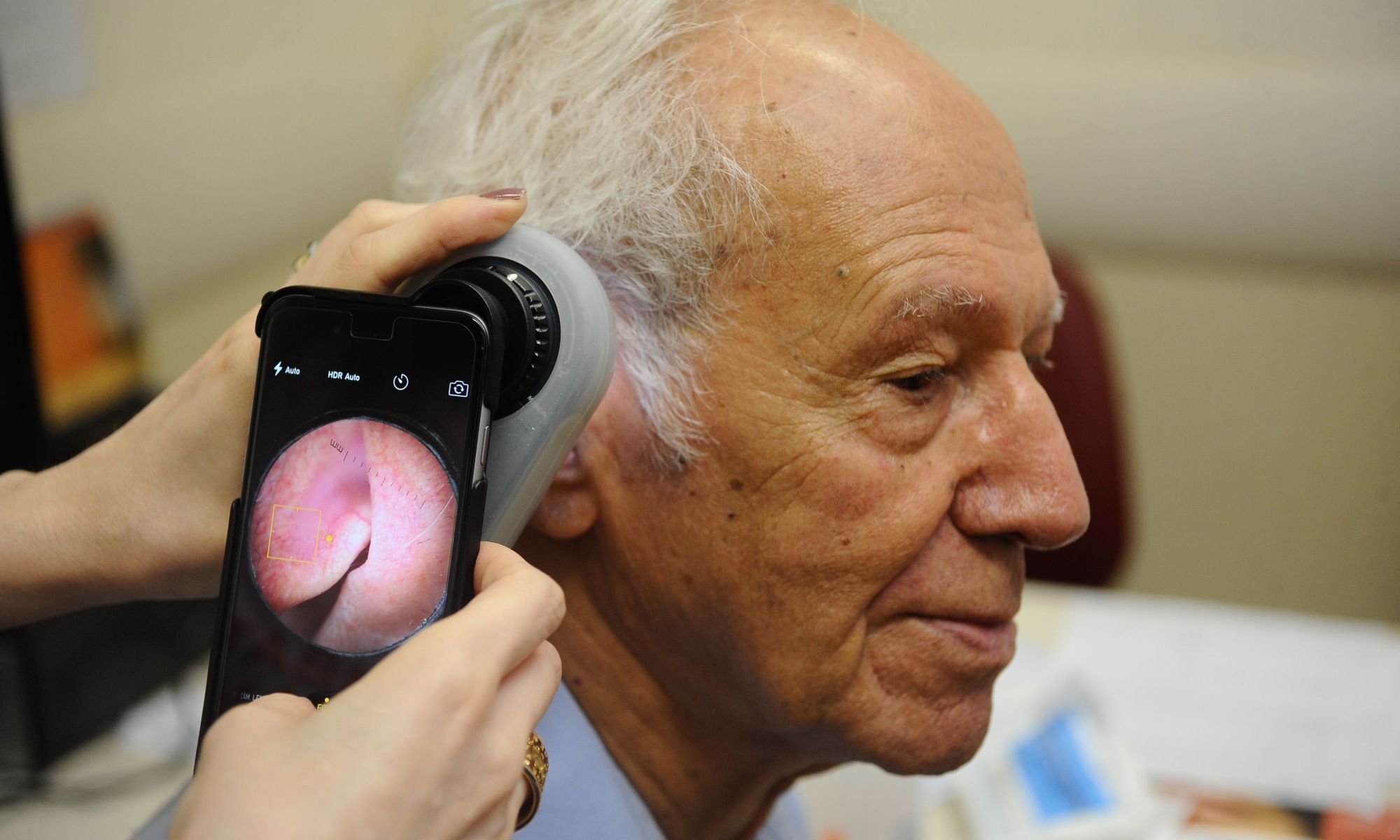 Câncer de pele: como diferenciar uma pinta de uma lesão mais grave?